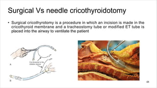 Intubation, Tracheostomy,Cricothyroidotomy.pdf