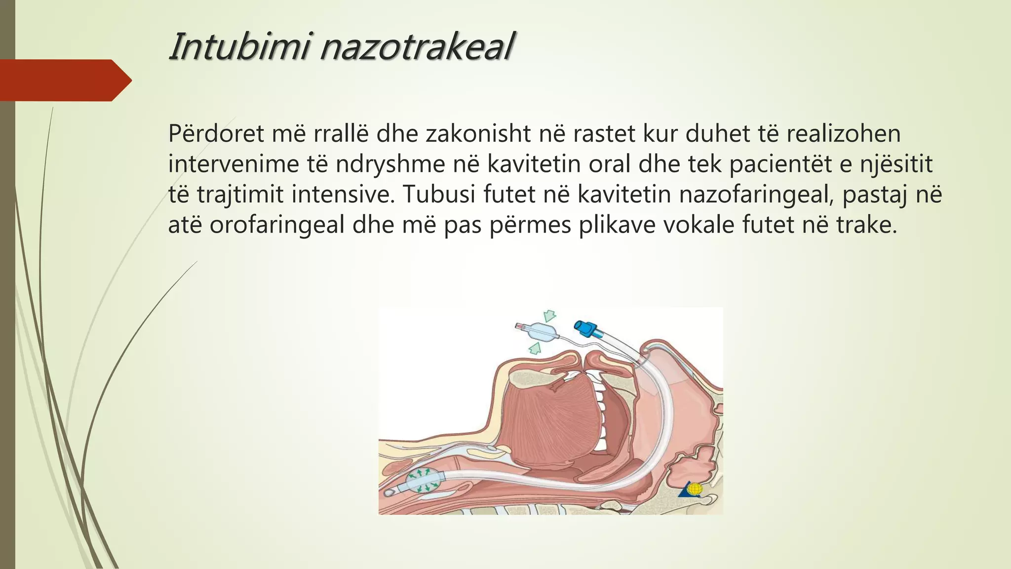 Intubimi endotrakeal | PPTX