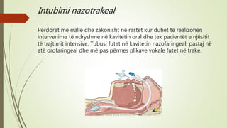 Intubimi endotrakeal | PPTX