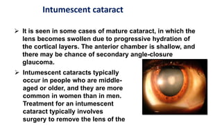 intumescent cataract_4138fe68-5bac-46d7-91e9-2d309ef41da2.pptx