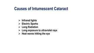 intumescent cataract_4138fe68-5bac-46d7-91e9-2d309ef41da2.pptx