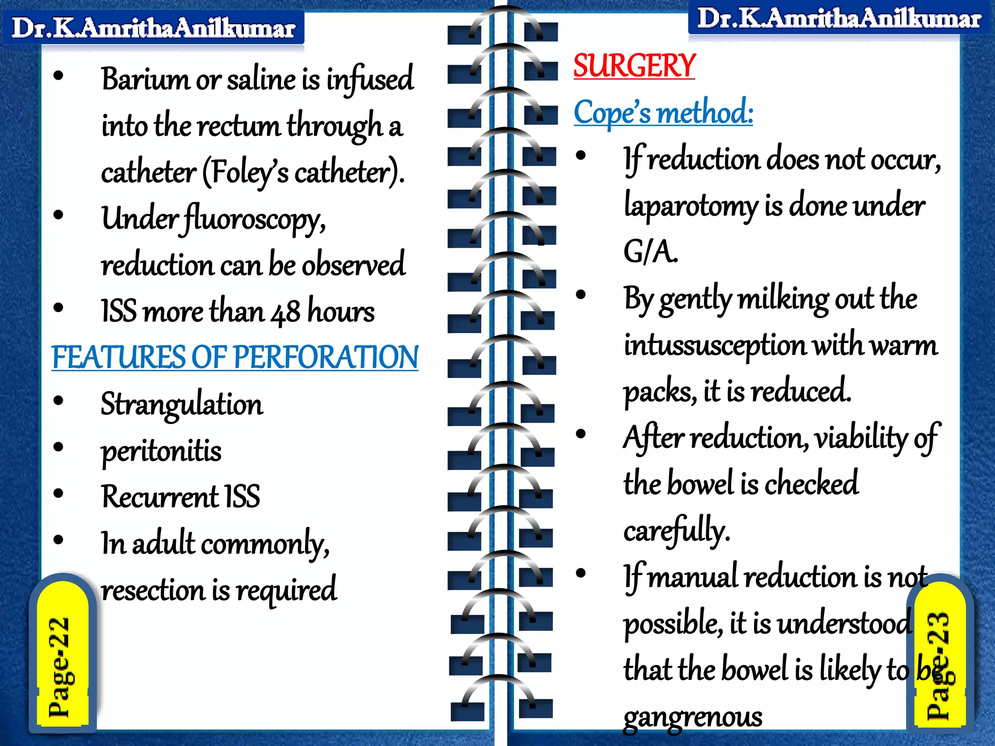 Intussusception by Dr.AmrithaAnilkumar | PPTX
