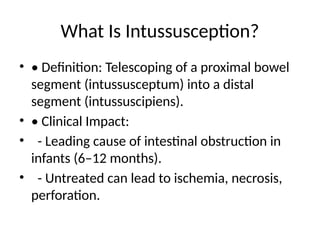 Intussuception pediatric surgery disease.pptx
