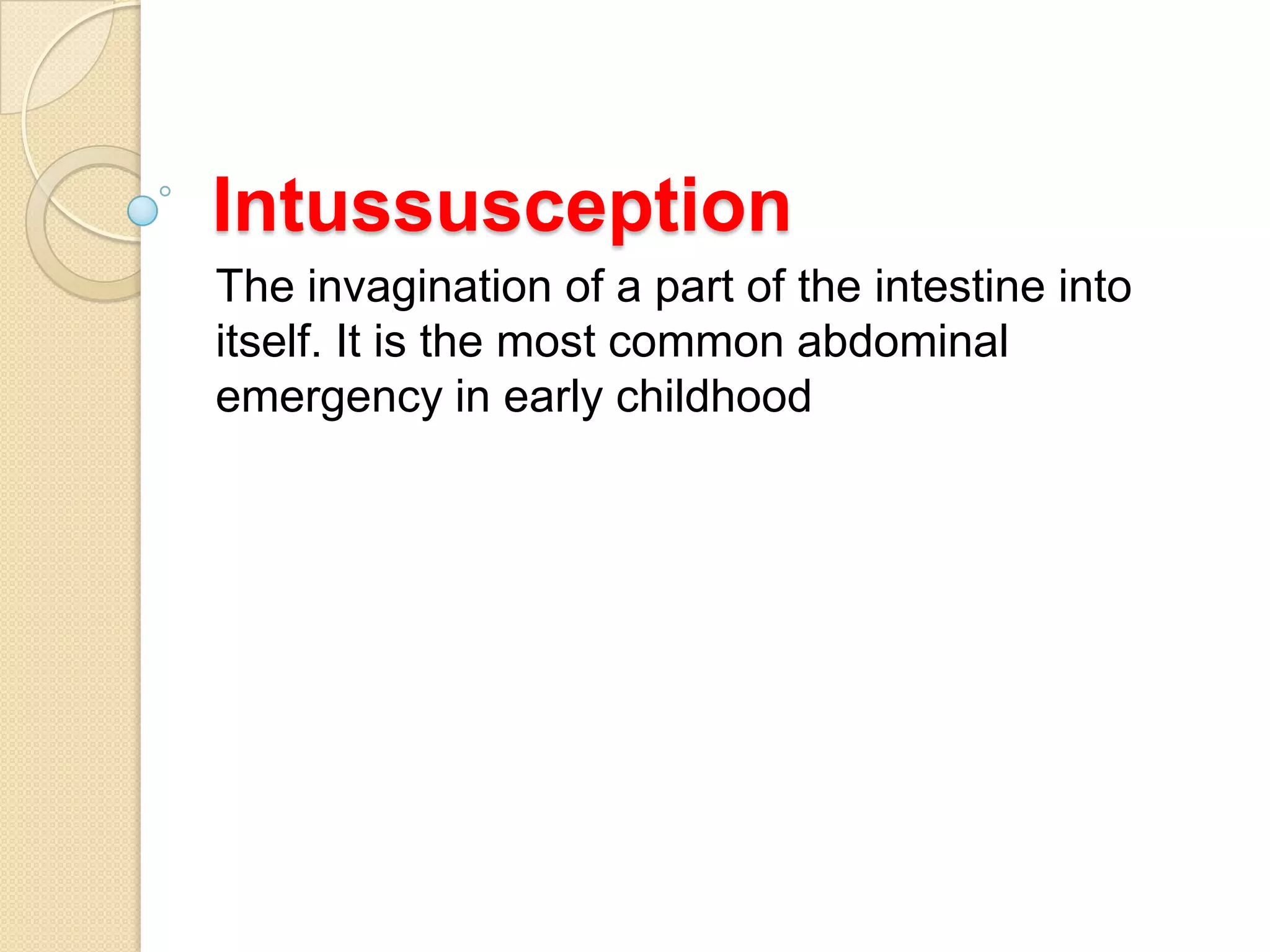 Intussusception in children | PPTX
