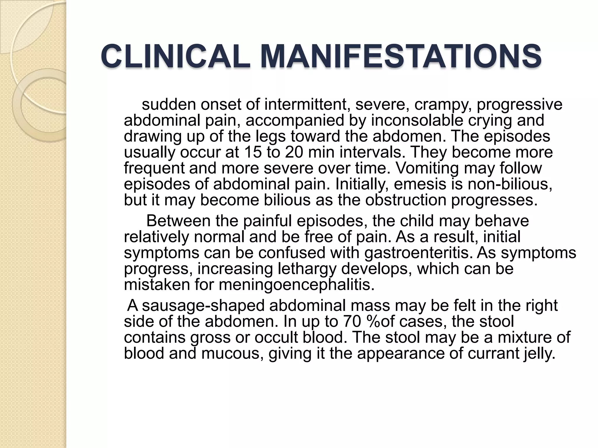 Intussusception in children | PPTX