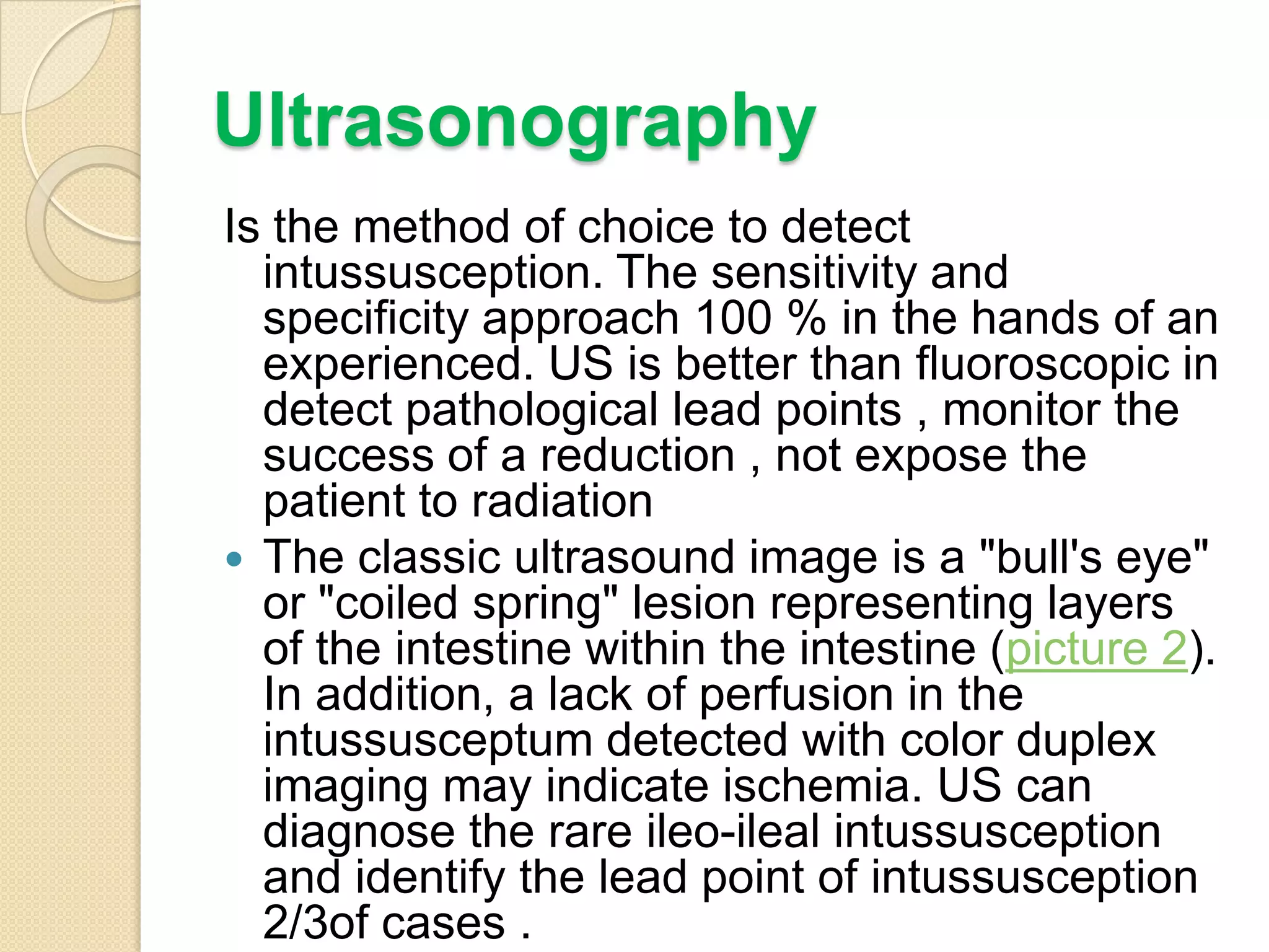 Intussusception in children | PPTX