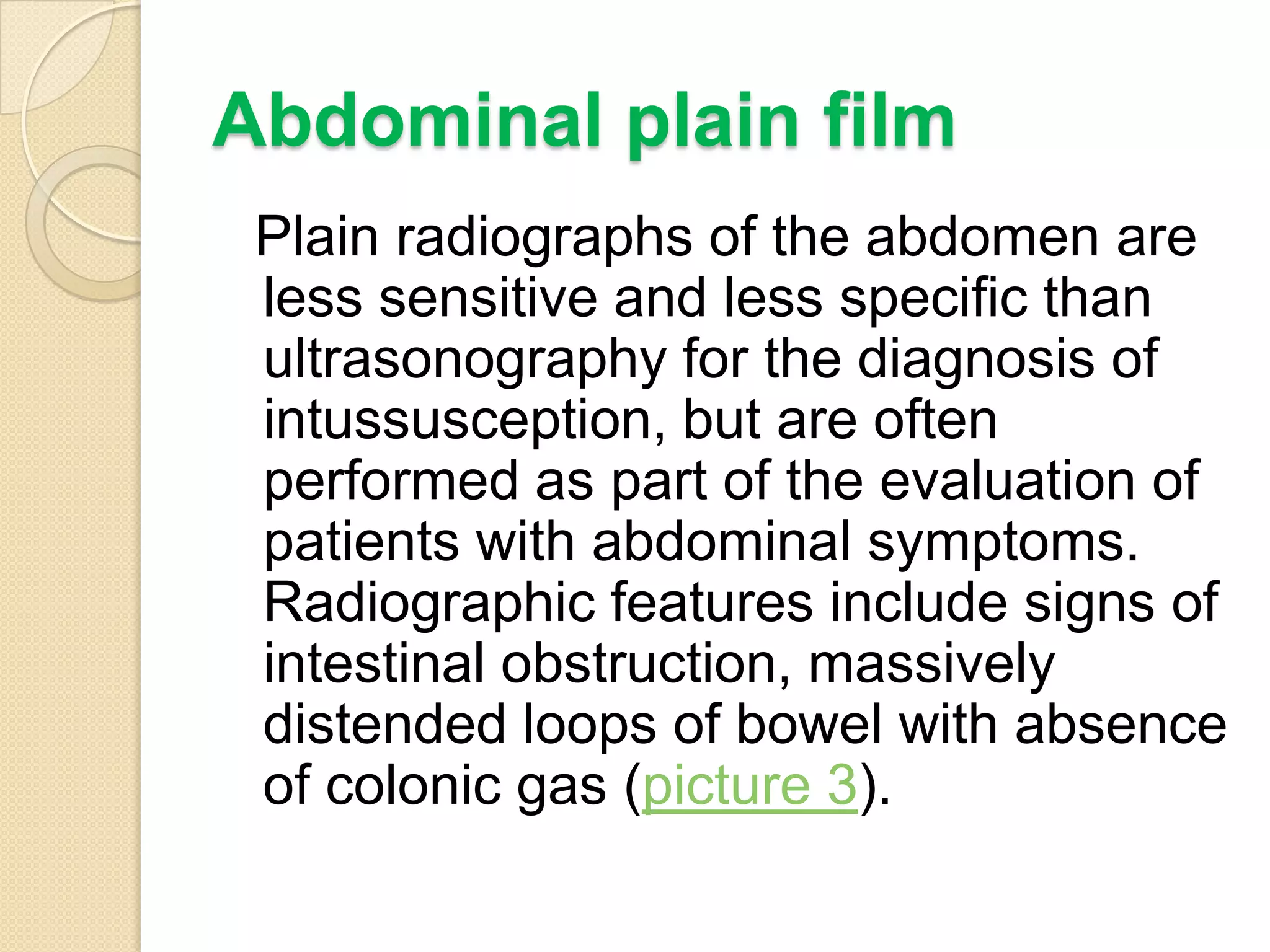 Intussusception in children | PPTX