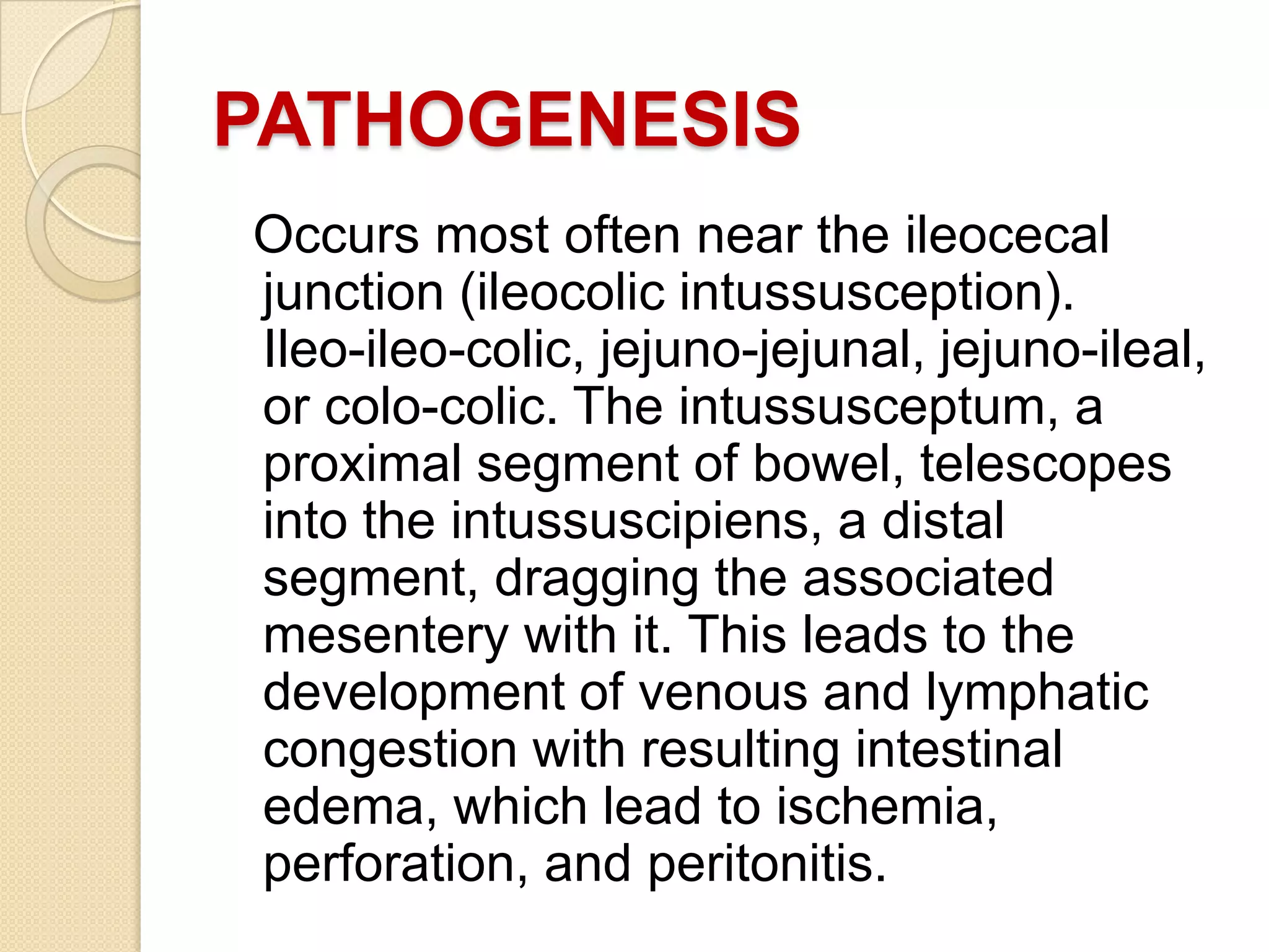 Intussusception in children | PPTX