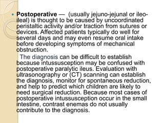 Intussusception in children | PPTX