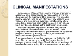 Intussusception in children | PPTX