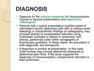 Intussusception in children | PPTX