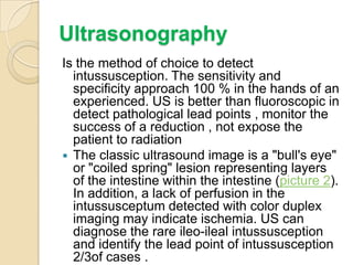 Intussusception in children | PPTX