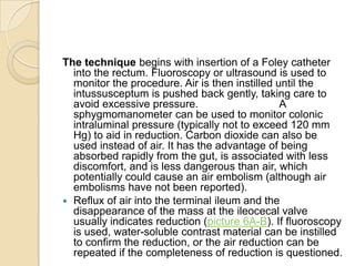 Intussusception in children | PPTX