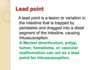 Intussusception in children | PPTX