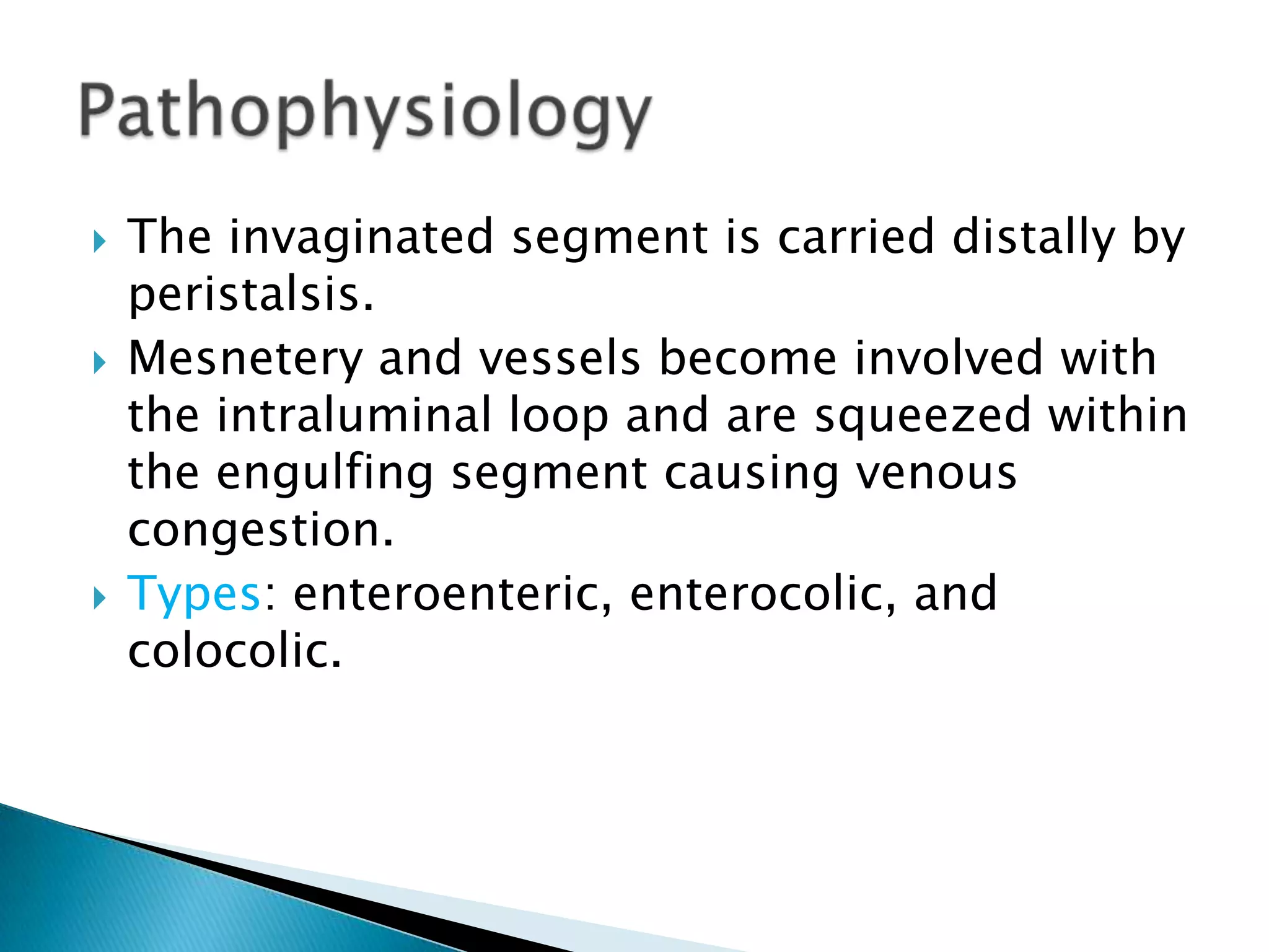 Intussusception | PPT