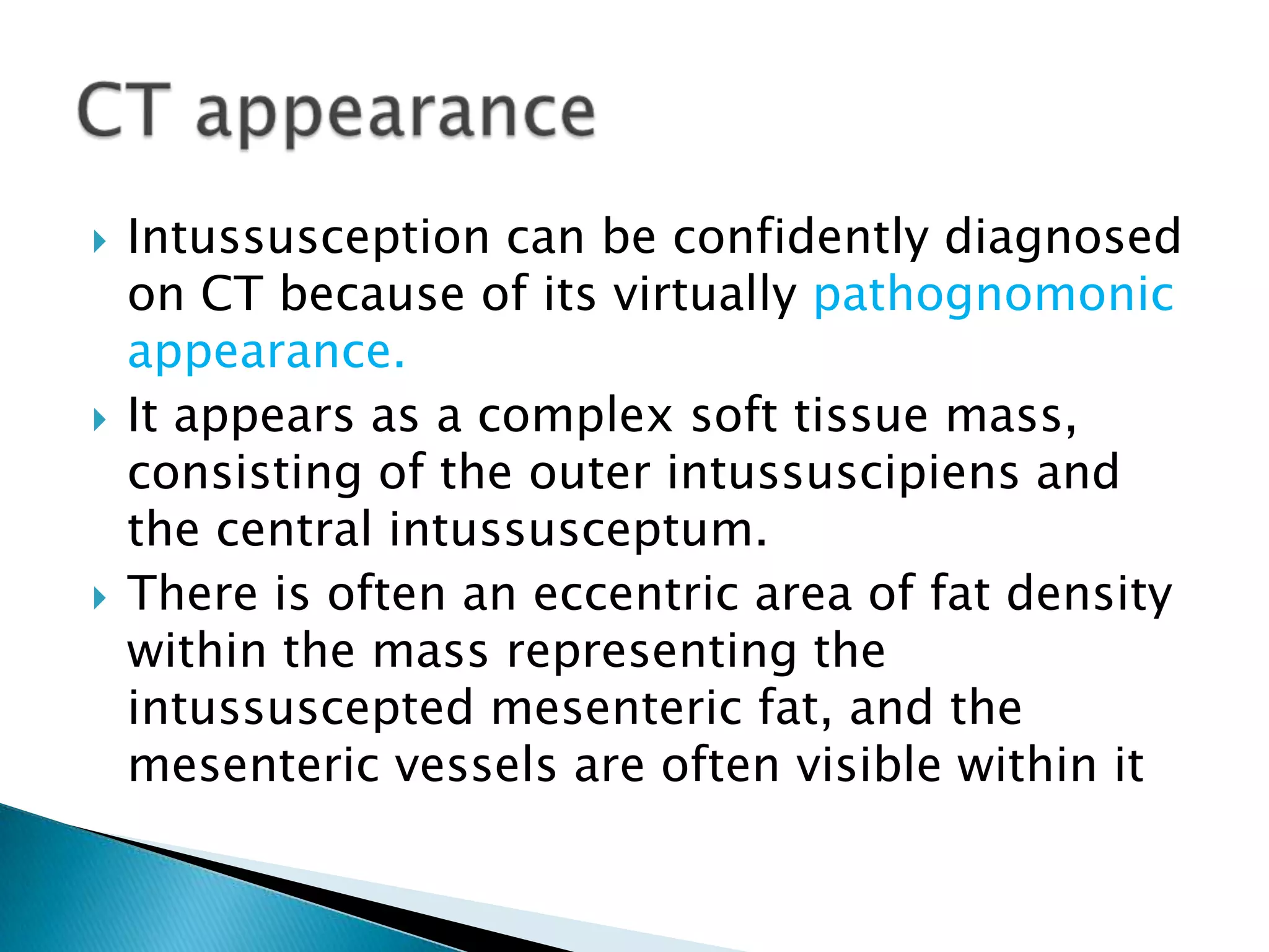 Intussusception | PPTX