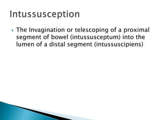 Intussusception | PPT