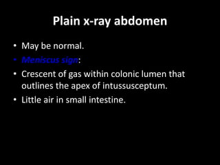 Intussusception | PPTX