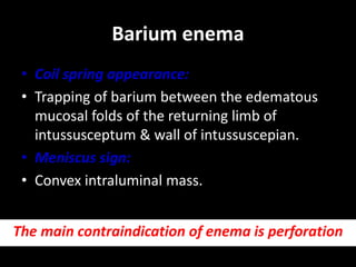 Intussusception Barium Enema