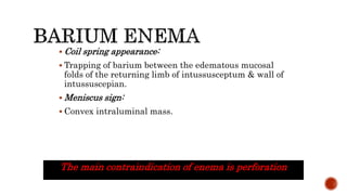 Intussusception | PPTX
