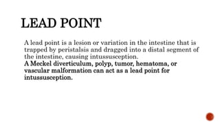 Intussusception | PPTX
