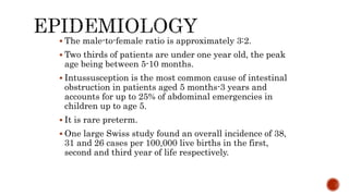 Intussusception | PPTX