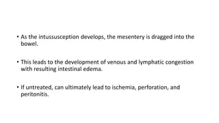 Intussusception - A Comprehensive Presentation | PPTX | Digestive ...