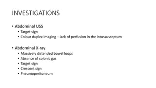 Intussusception - A Comprehensive Presentation | PPTX