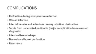 Intussusception - A Comprehensive Presentation | PPTX