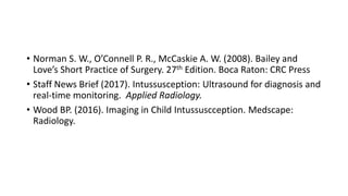 Intussusception - A Comprehensive Presentation | PPTX