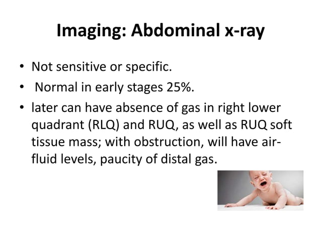 Intussusception | PPTX | Digestive Disorders | Diseases and Conditions