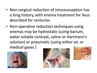 Intussusception | PPTX | Digestive Disorders | Diseases and Conditions