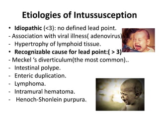 Intussusception | PPTX | Digestive Disorders | Diseases and Conditions