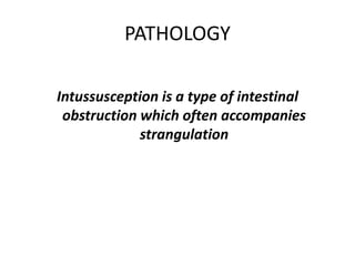 INTUSSUSCEPTION.pptx