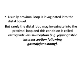 INTUSSUSCEPTION.pptx