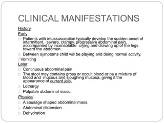 intussusception.pptx