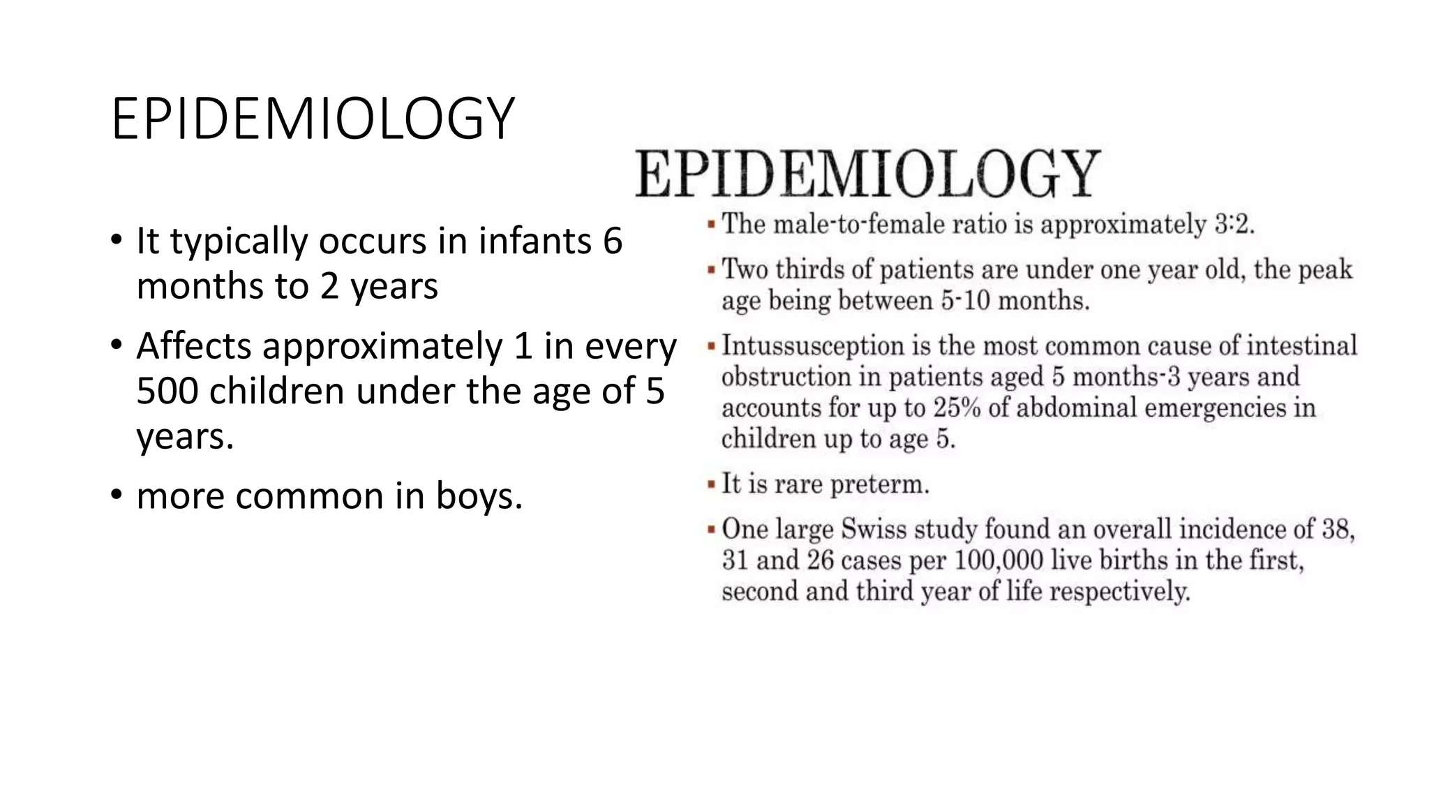 intussusception.pptx | Digestive Disorders | Diseases and Conditions