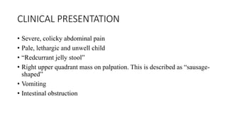 intussusception.pptx | Digestive Disorders | Diseases and Conditions