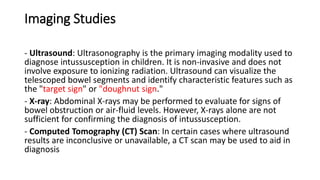 intussusception.pptx | Digestive Disorders | Diseases and Conditions