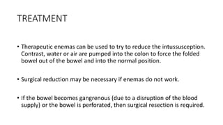 intussusception.pptx | Digestive Disorders | Diseases and Conditions