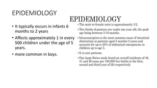 intussusception.pptx | Digestive Disorders | Diseases and Conditions