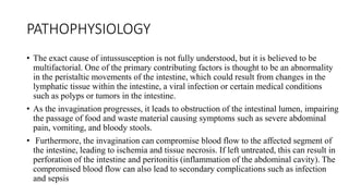 intussusception.pptx | Digestive Disorders | Diseases and Conditions