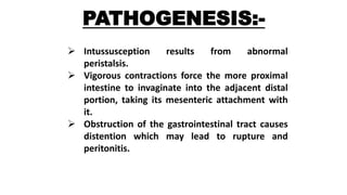 INTUSSUSCEPTION.pdf