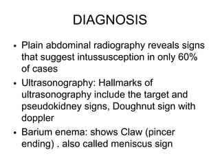 intussusception.pdf
