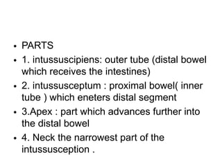 intussusception.pdf