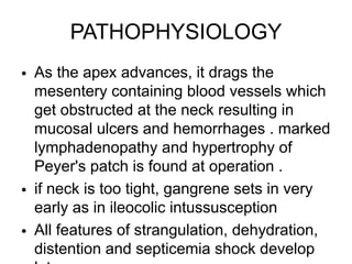 intussusception.pdf
