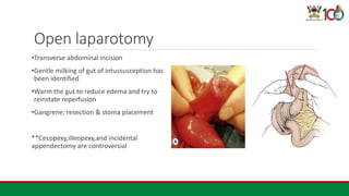 Neonatal intestinal Obstruction_ Intussusception.pptx