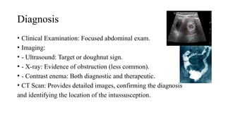 Intussusception.pptx SURGERY PRESENTATION | PPT