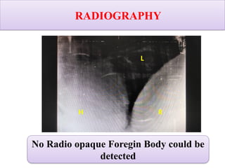 Successful management of intussusception in a cow under double drip ...