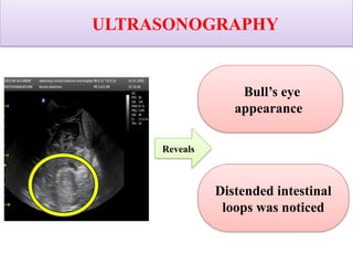 Successful management of intussusception in a cow under double drip ...
